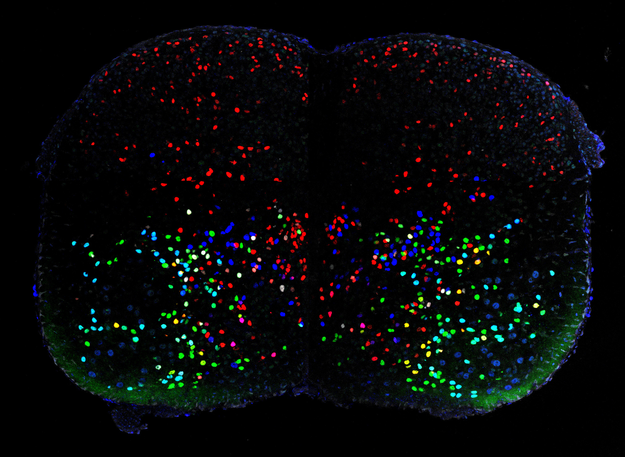 Thomas Jessell: Linking Molecules to Perception and Motion - Rita Allen ...