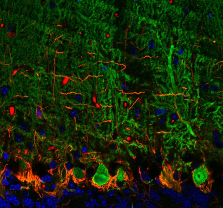 Tom Maniatis: Mastering Methods and Exploring Molecular Mechanisms ...